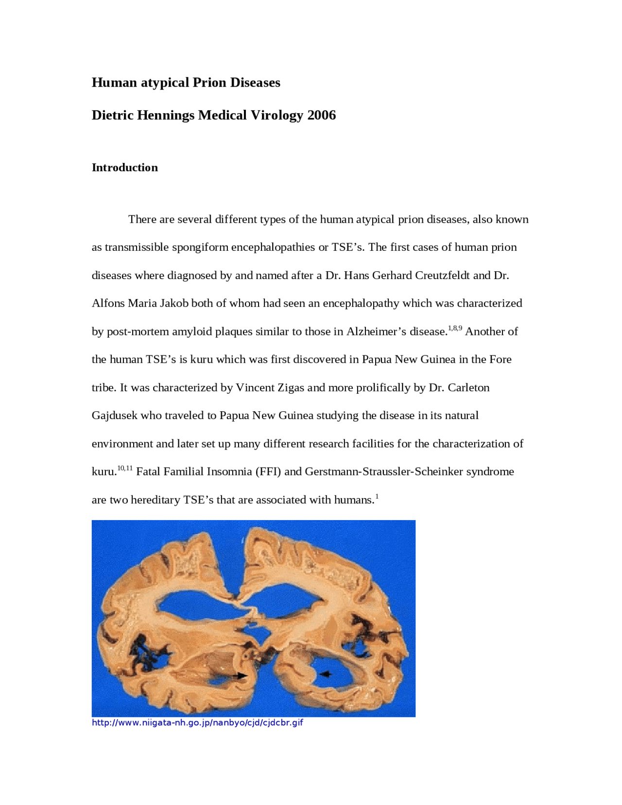 Human A Typical Prion Diseases Lecture Notes Patb 4710 Docsity