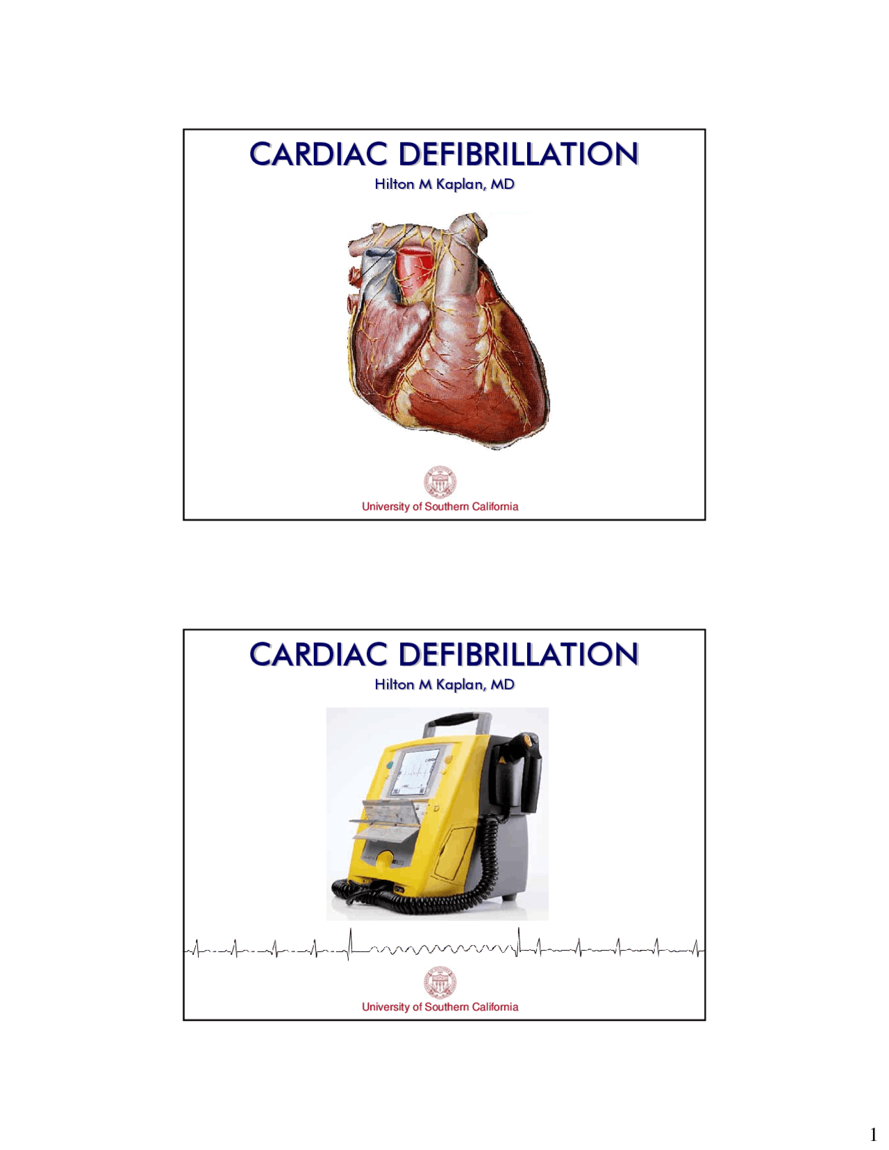 Cardiac Defibrillation - Applied Electrophysiology - Lecture Slides ...