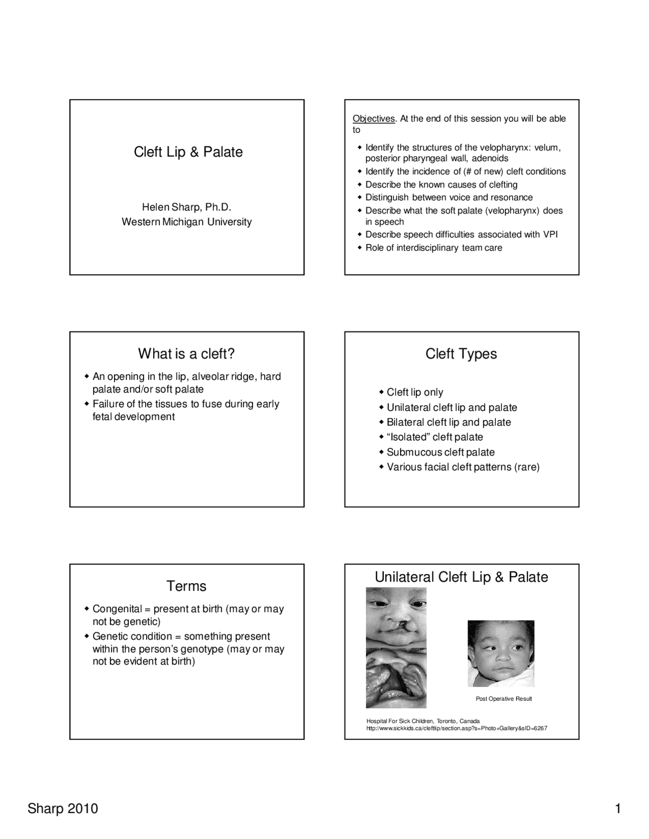 Cleft Lip And Palate Lecture Slides Sppa 2000 Docsity