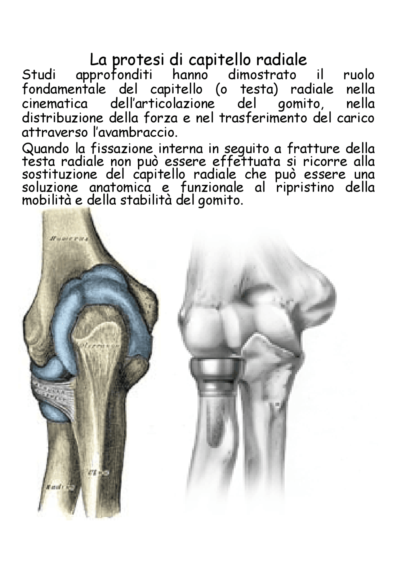 Il capitello radiale - Docsity