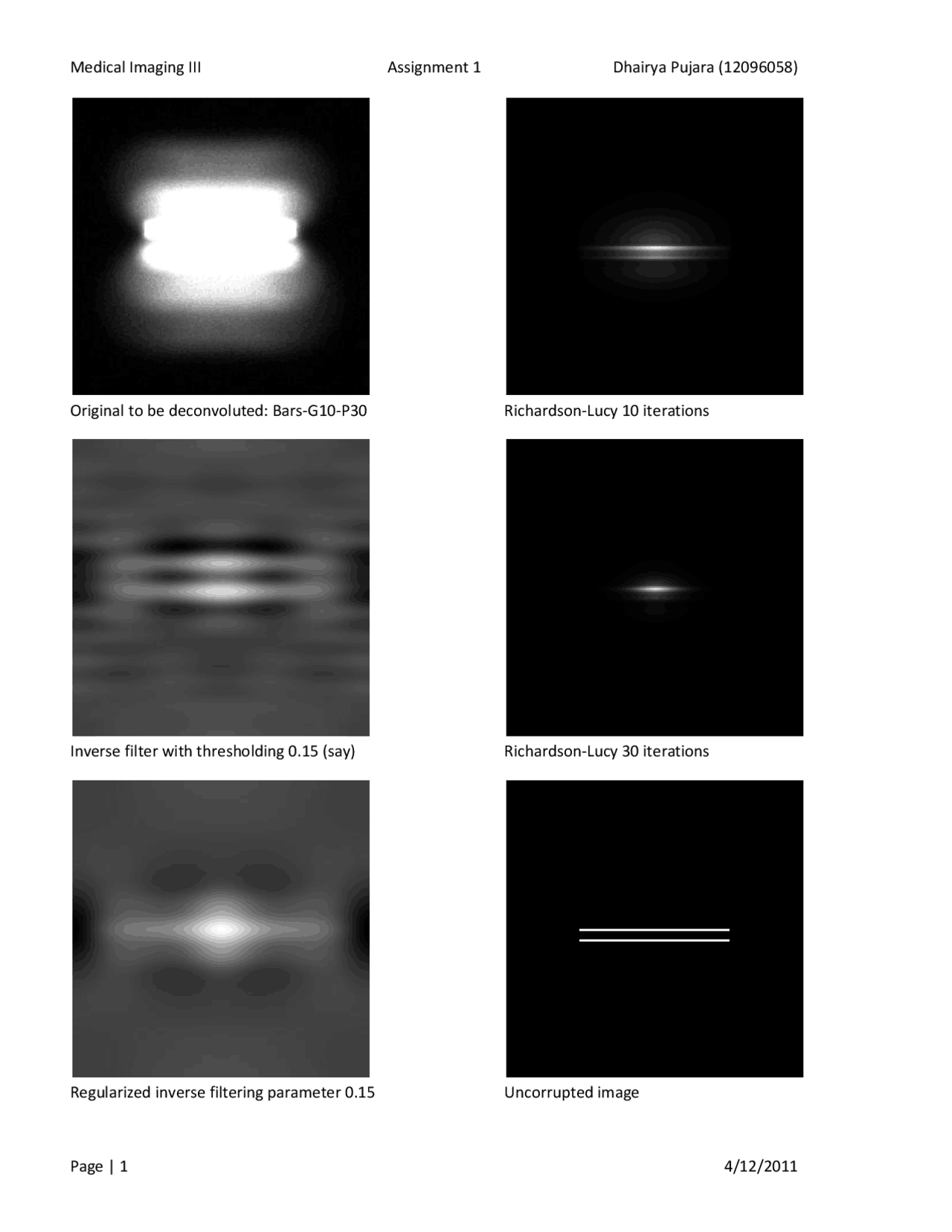 Comparison of Image Deconvolution Techniques in Medical Imaging: Inverse Filtering, Regula ...