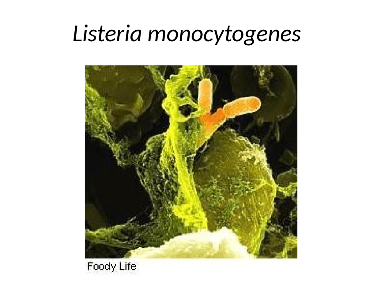 Lecture Notes on Listeria Monocytogene - Pathogenic Micro | BIO 4405 ...