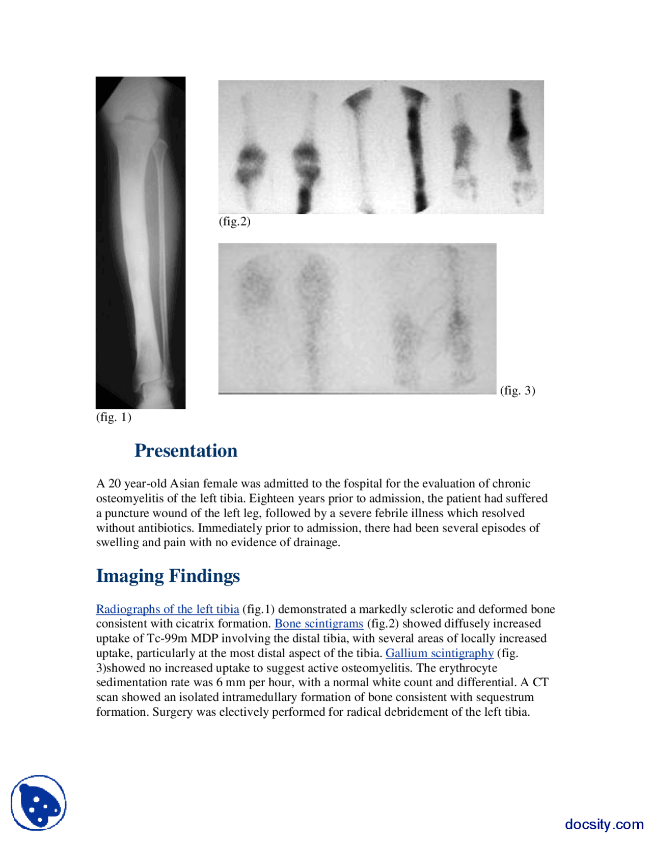 Imaging Findings Bones Lecture Slides Docsity