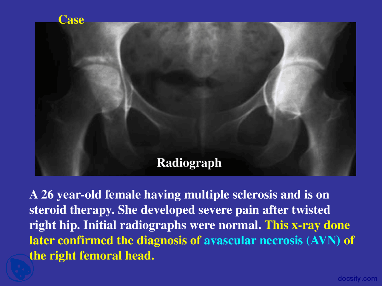 Radiograph Bones Lecture Slides Docsity