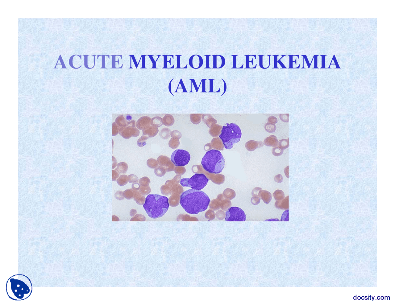 Acute Myeloid Leukemia-Genetics-Lecture Slides | Slides Genetics | Docsity
