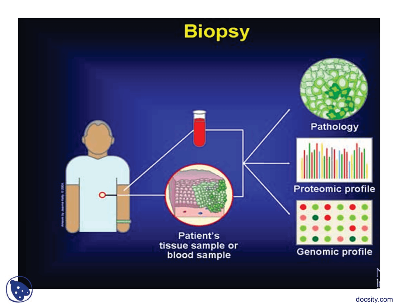Cancer Detection And Diagonosis Part 2 Cancer Cytogenetic Lecture