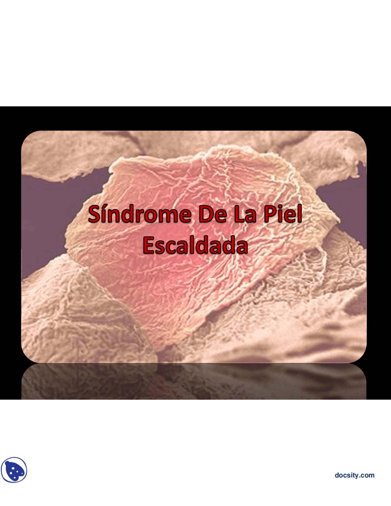 Síndrome De La Piel Escaldada - Microbiología - Diapositivas ...