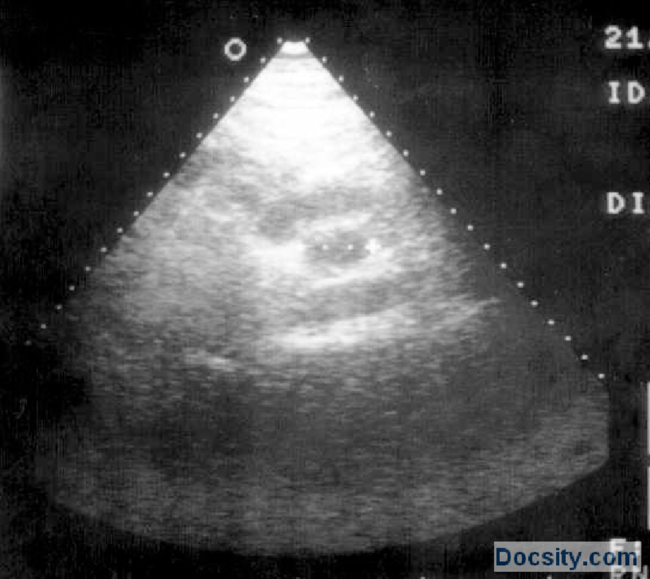 Ultrazvuk snimci-Vezbe-Radiologija-Medicina 3 | Vežbe' predlog ...