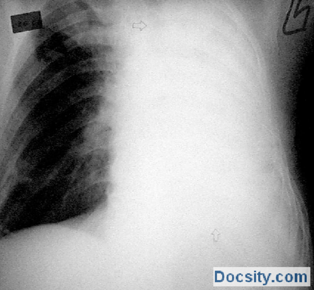 Pluca snimci-Vezbe-Radiologija-Medicina Part5 | Vežbe' predlog ...