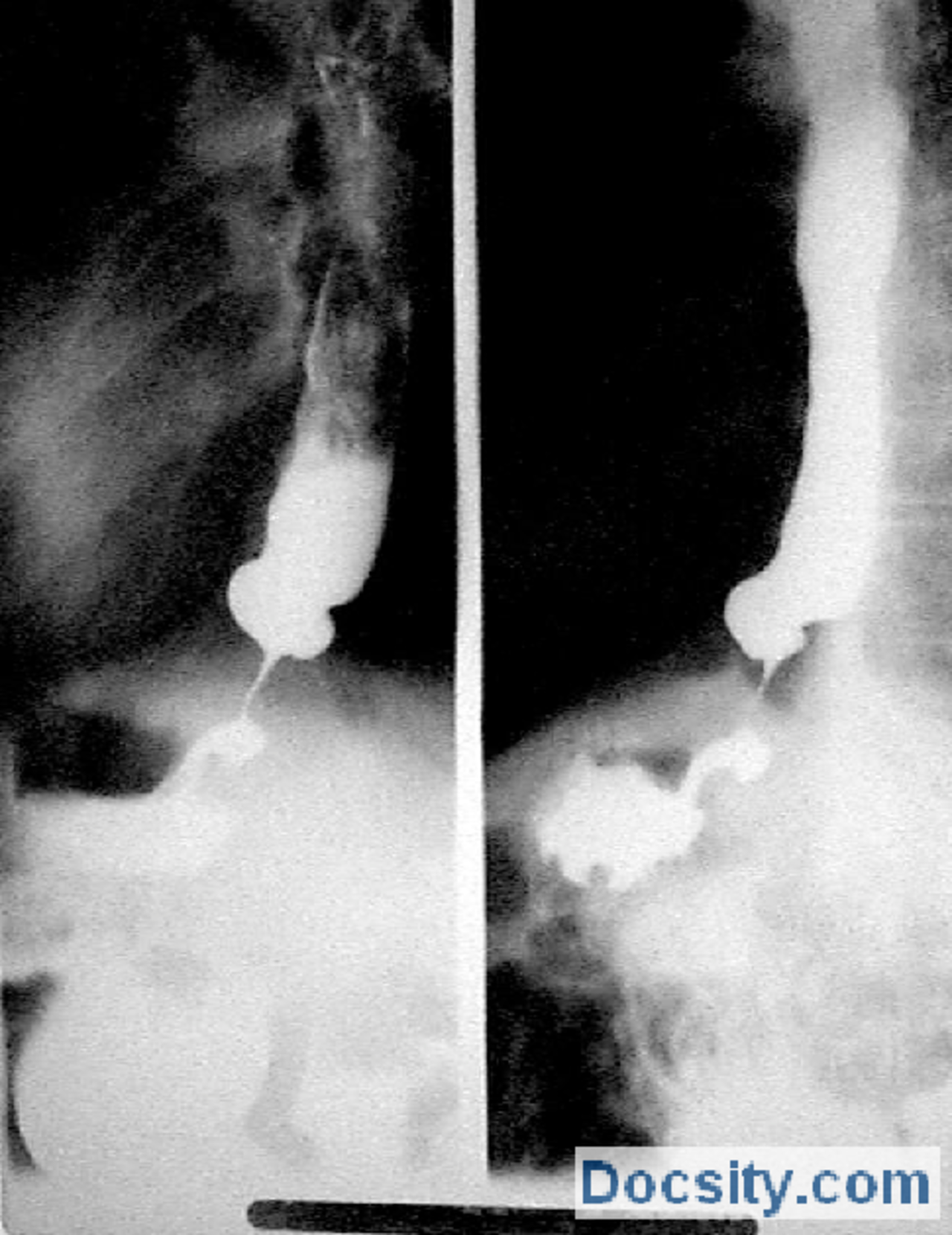 Jednjak snimci-Vezbe-Radiologija-Medicina Part1 | Vežbe' predlog ...
