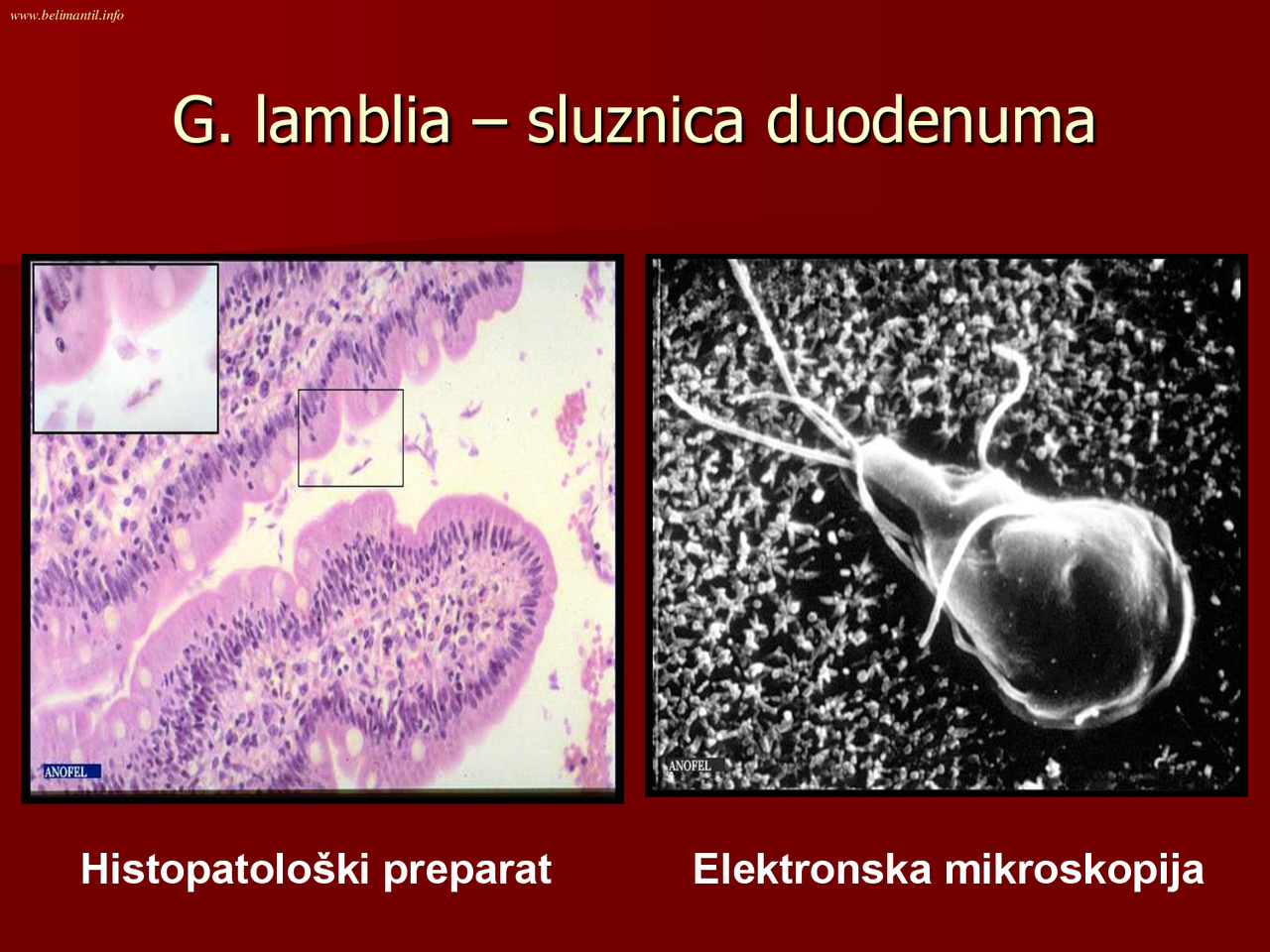 Sluznica duodeuma-Vezbe-Parazitologija-Medicina | Vežbe' predlog ...
