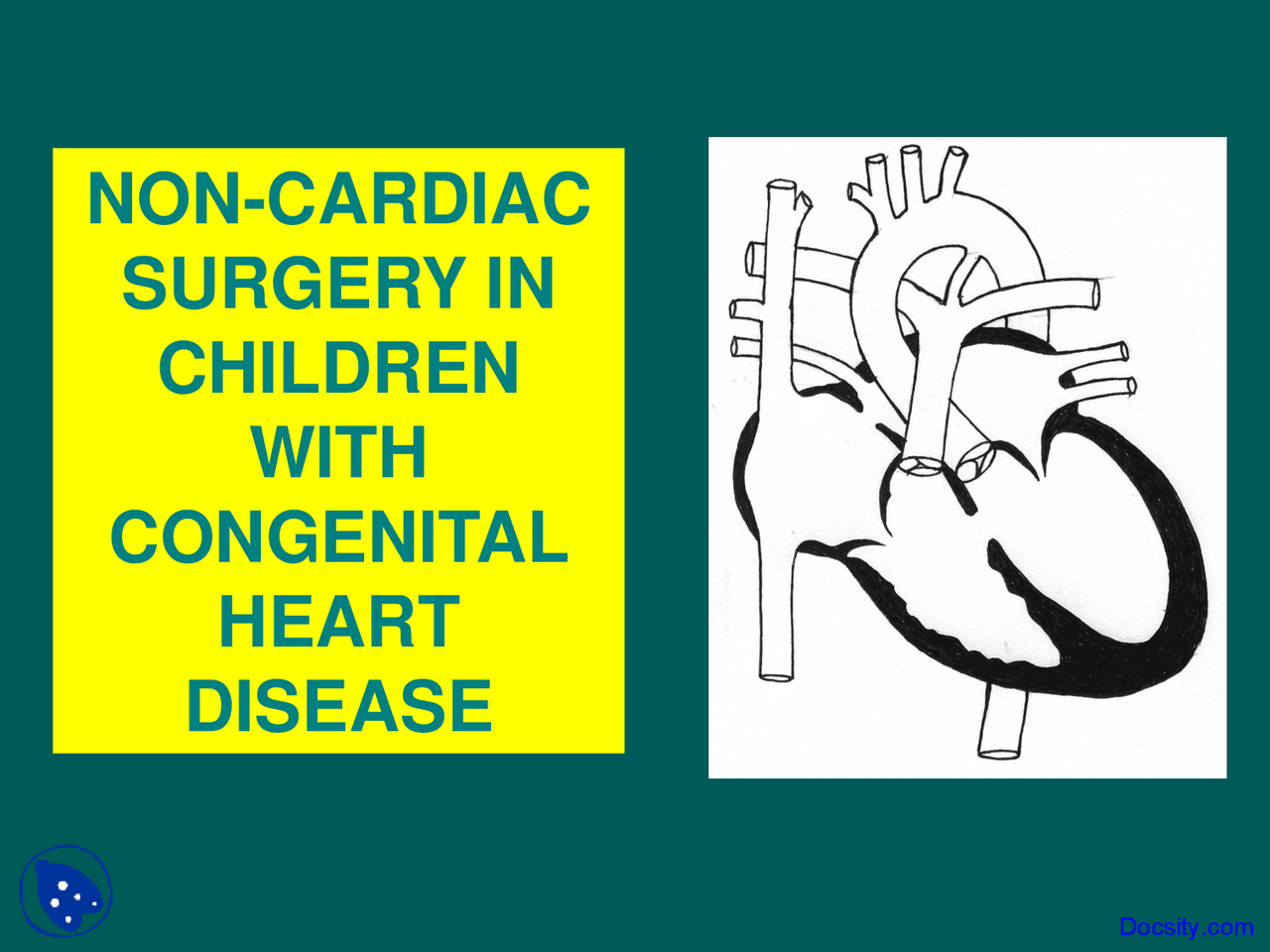 Non Cardiac Surgery Anesthesia Lecture Slides Docsity