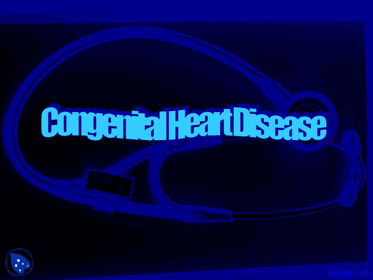 Ventricular Septal Defect Cardiology Lecture Slides Docsity