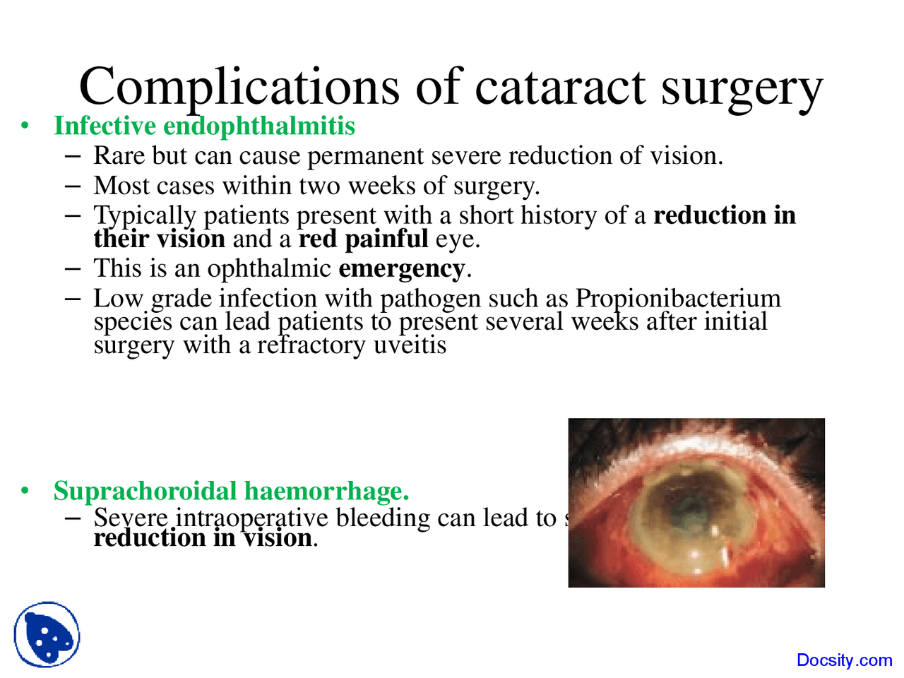 Complications of Cataract Surgery - Introduction to Ophthalmology ...