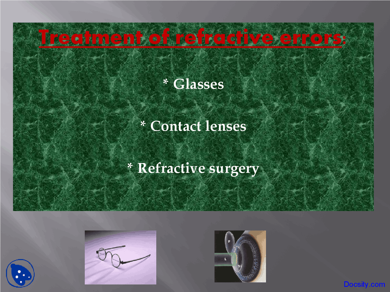 Treatment of Refractive Errors - Introduction to Ophthalmology - Lecture Slides - Docsity