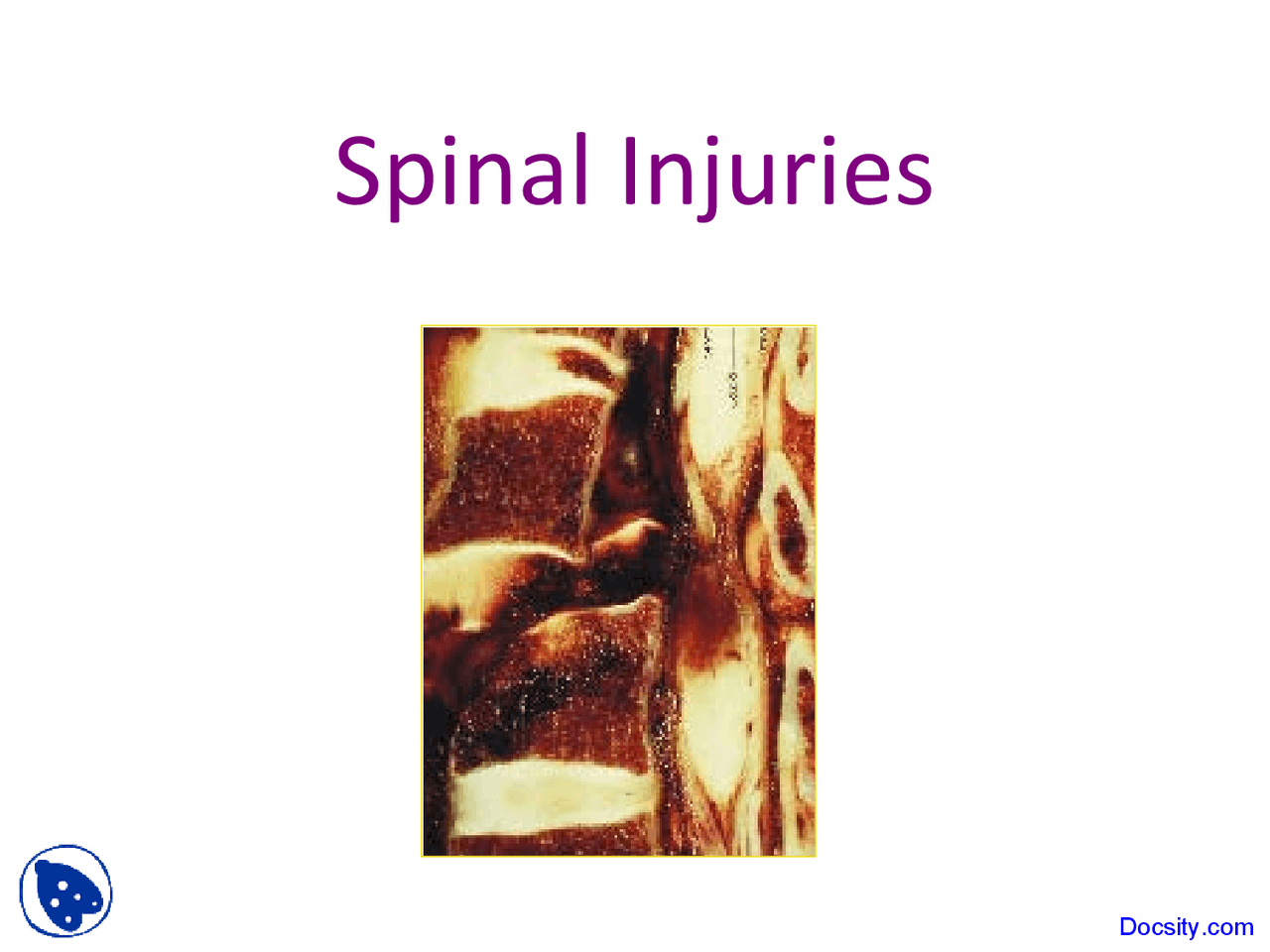 Spinal Injuries Introduction To Neurology Lecture Slides Docsity