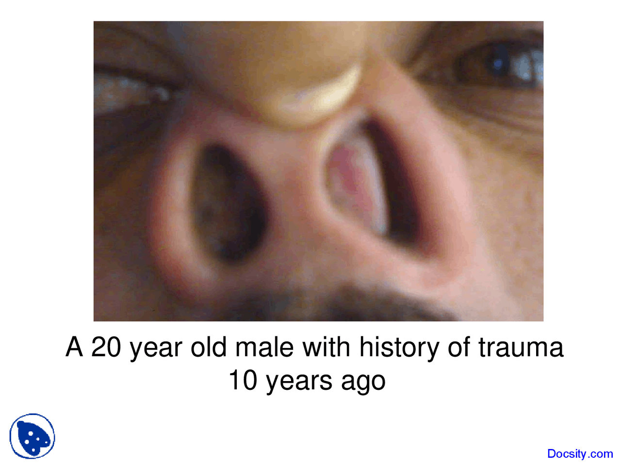 Regular Aural Toilet - Otolaryngology - Lecture Slides | Slides ...