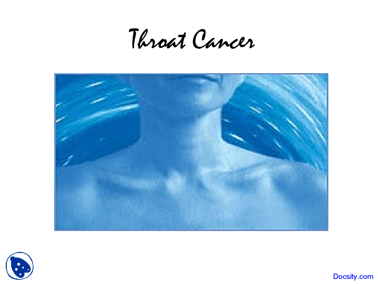 Throat Cancer Introduction To Oncology Lecture Slides Docsity