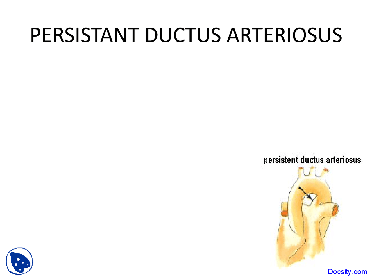 Persistant Ductus Arteriosus Neonatology Lecture Slides Docsity