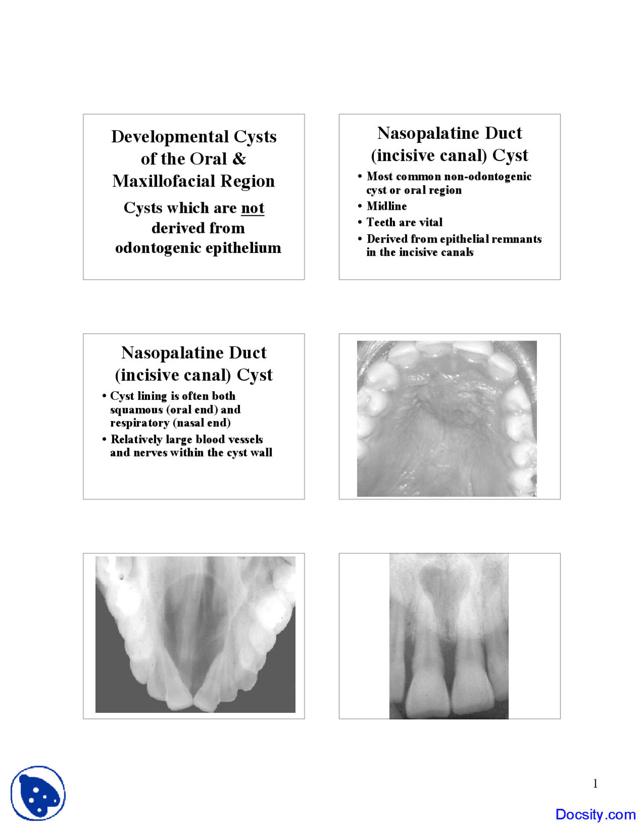 Developmental Cysts of Oral - Oral and Maxillofacial Pathology ...