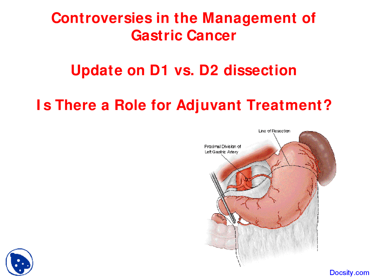 Gastric Cancer - Surgery - Lecture Slides - Docsity
