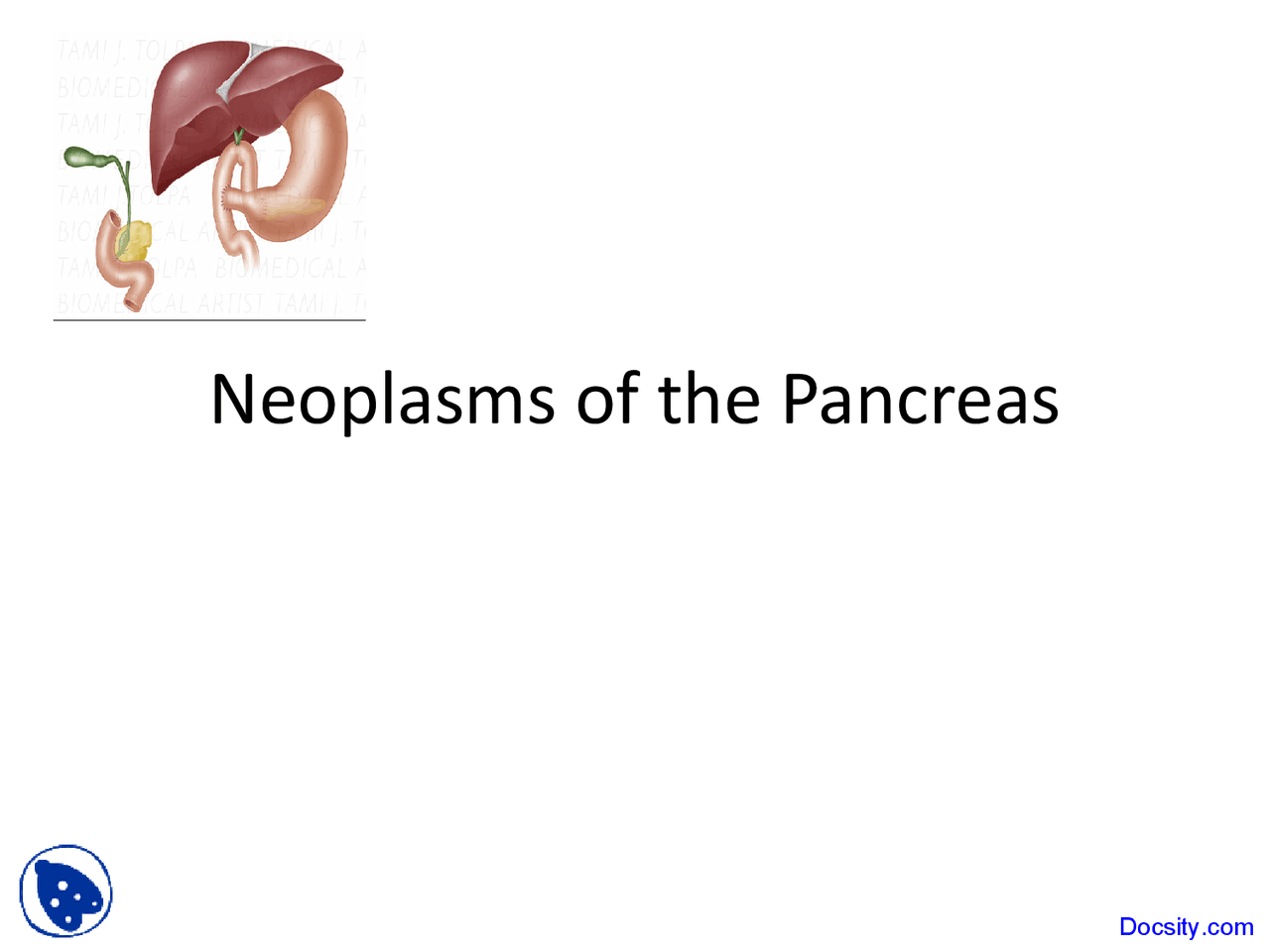 Neoplasms of Pancreas - Surgery - Lecture Slides - Docsity