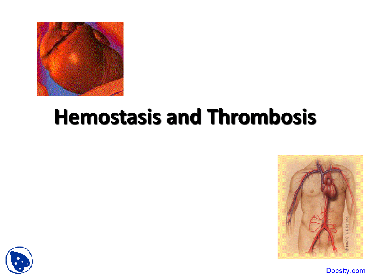 Hemostasis and Thrombosis - Surgery - Lecture Slides - Docsity