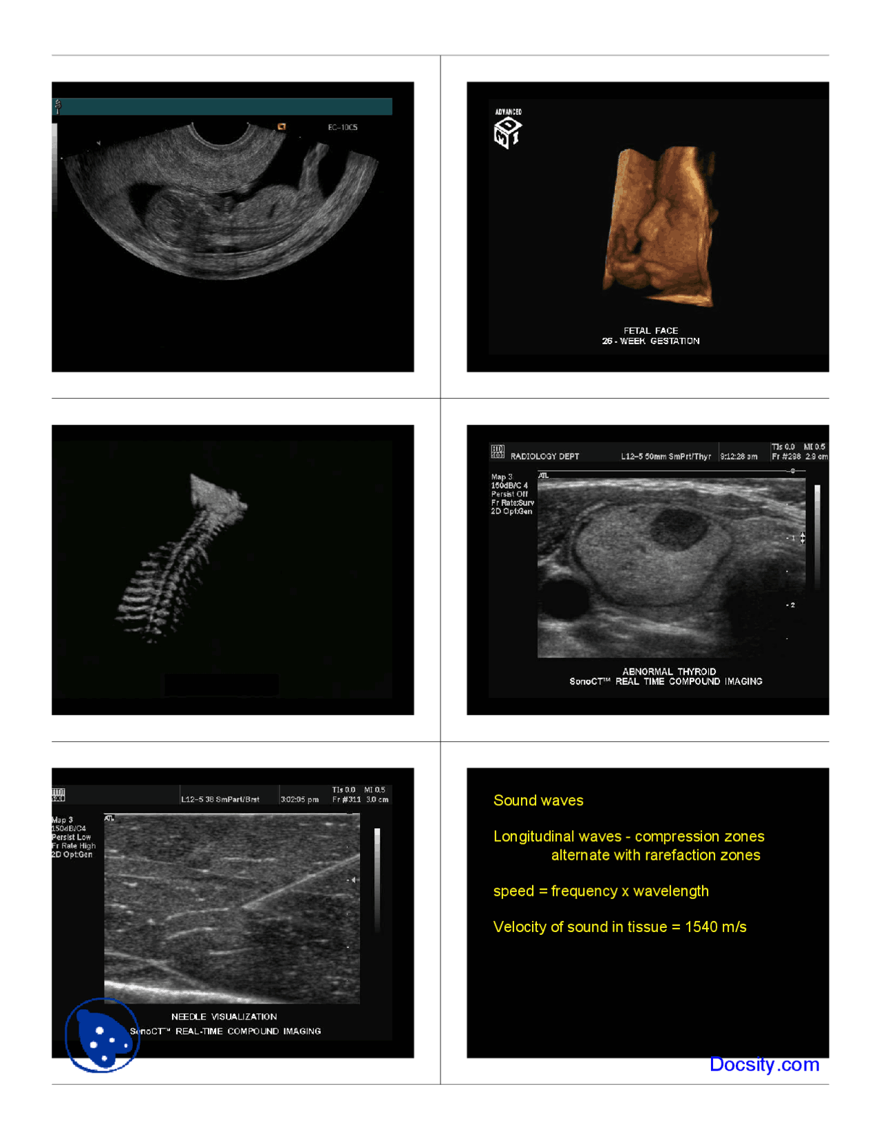 Ultrasound Saloner Radiology Lecture Slides Docsity