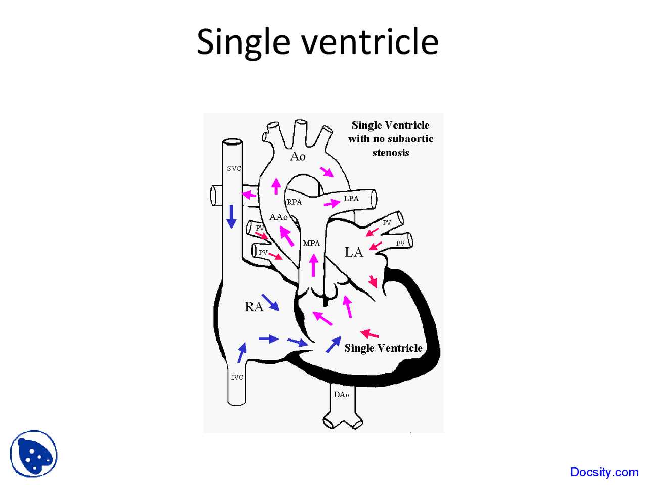 Single Ventricle Paediatrics Lecture Slides Docsity