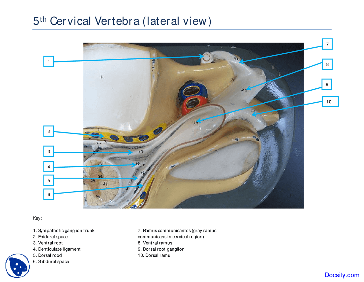 Anatomy of the 5th Cervical Vertebra: A Lateral View with Key ...