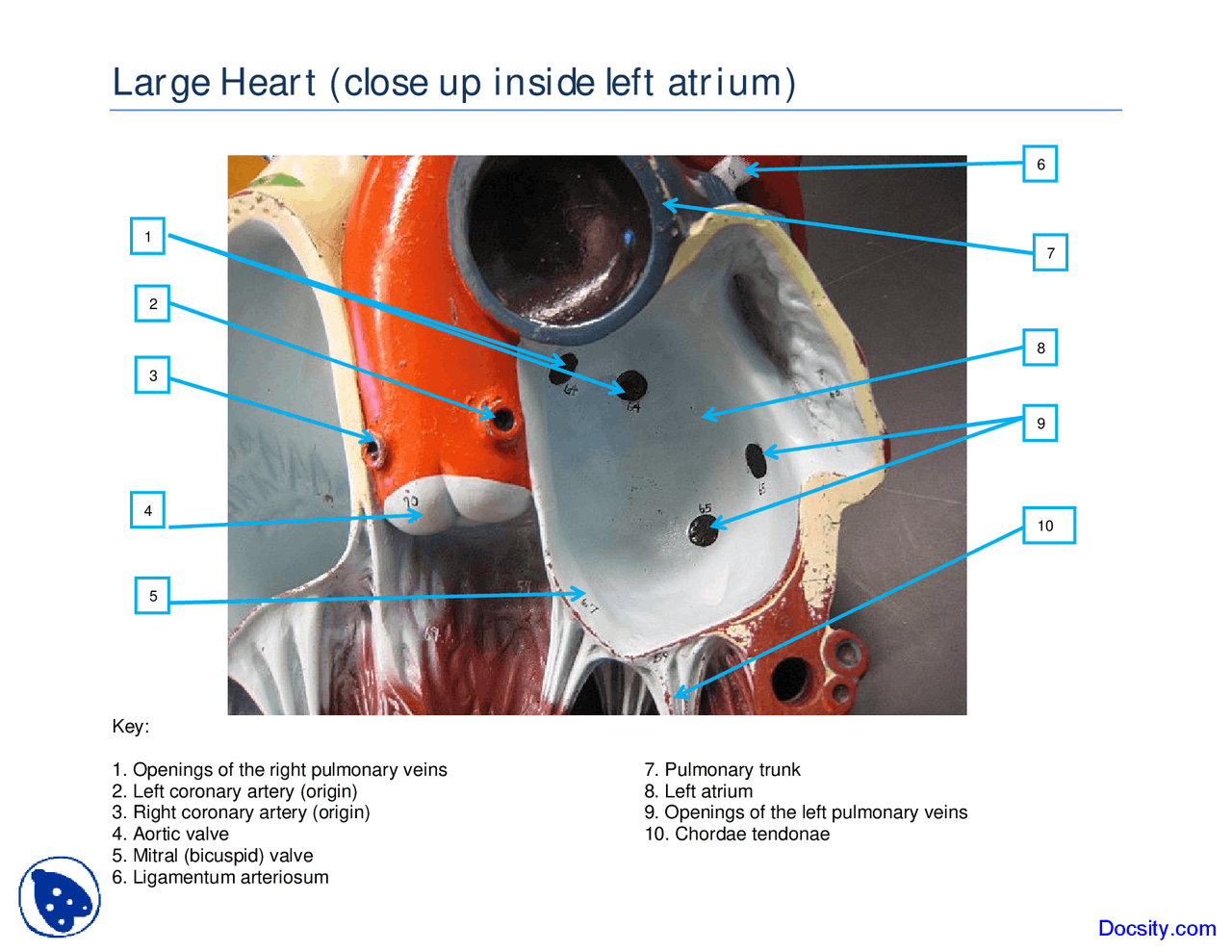 Large Heart Inside Left Atrium - Human Anatomy - Handout - Docsity