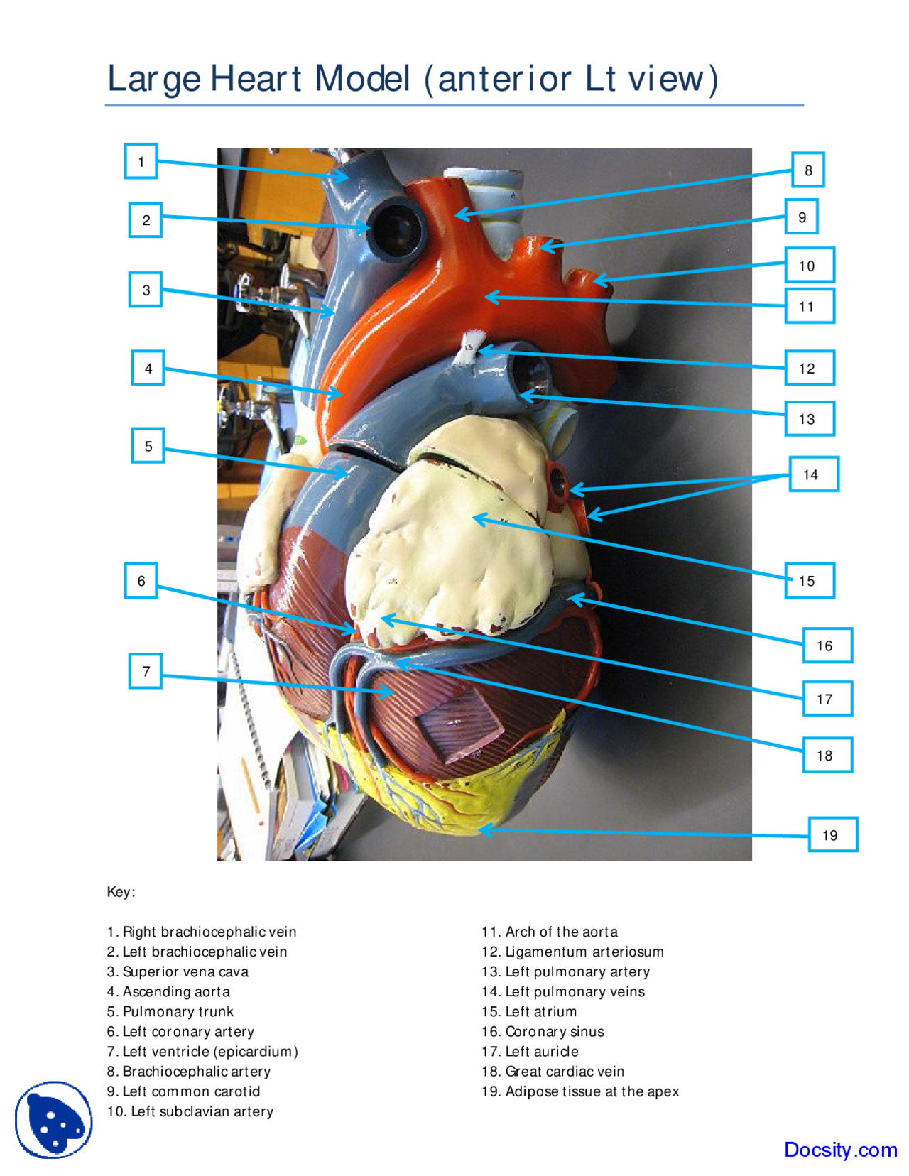 Large Heart Model Anterior Lateral View Human Anatomy Handout Docsity large-heart-model-anterior-lateral-view-human-anatomy-handout-docsity