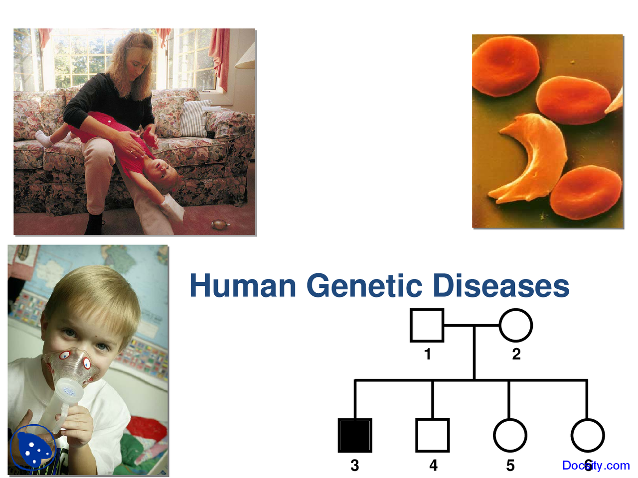 Human Genetic Diseases - Application of Biology - Lecture Slides ...