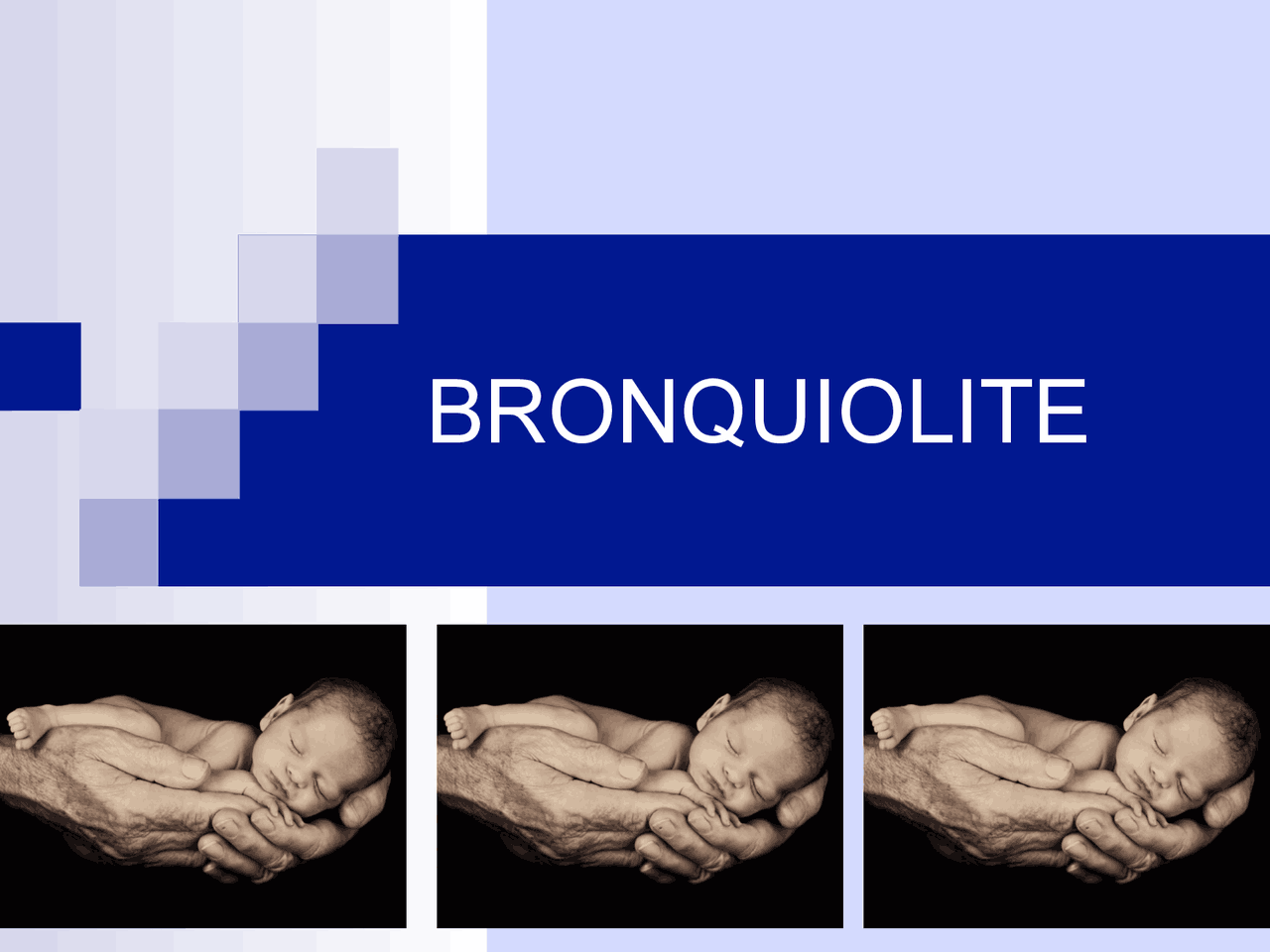 Bronquiolite - Apostilas - pediatria | Apuntes Pediatría | Docsity
