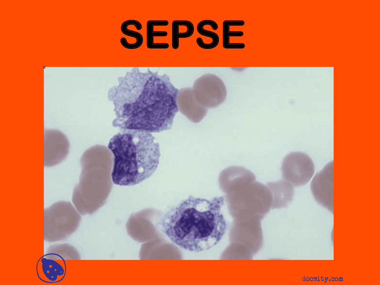 Sepse - Apostilas - pediatria Parte1 | Notas de estudo Pediatria | Docsity