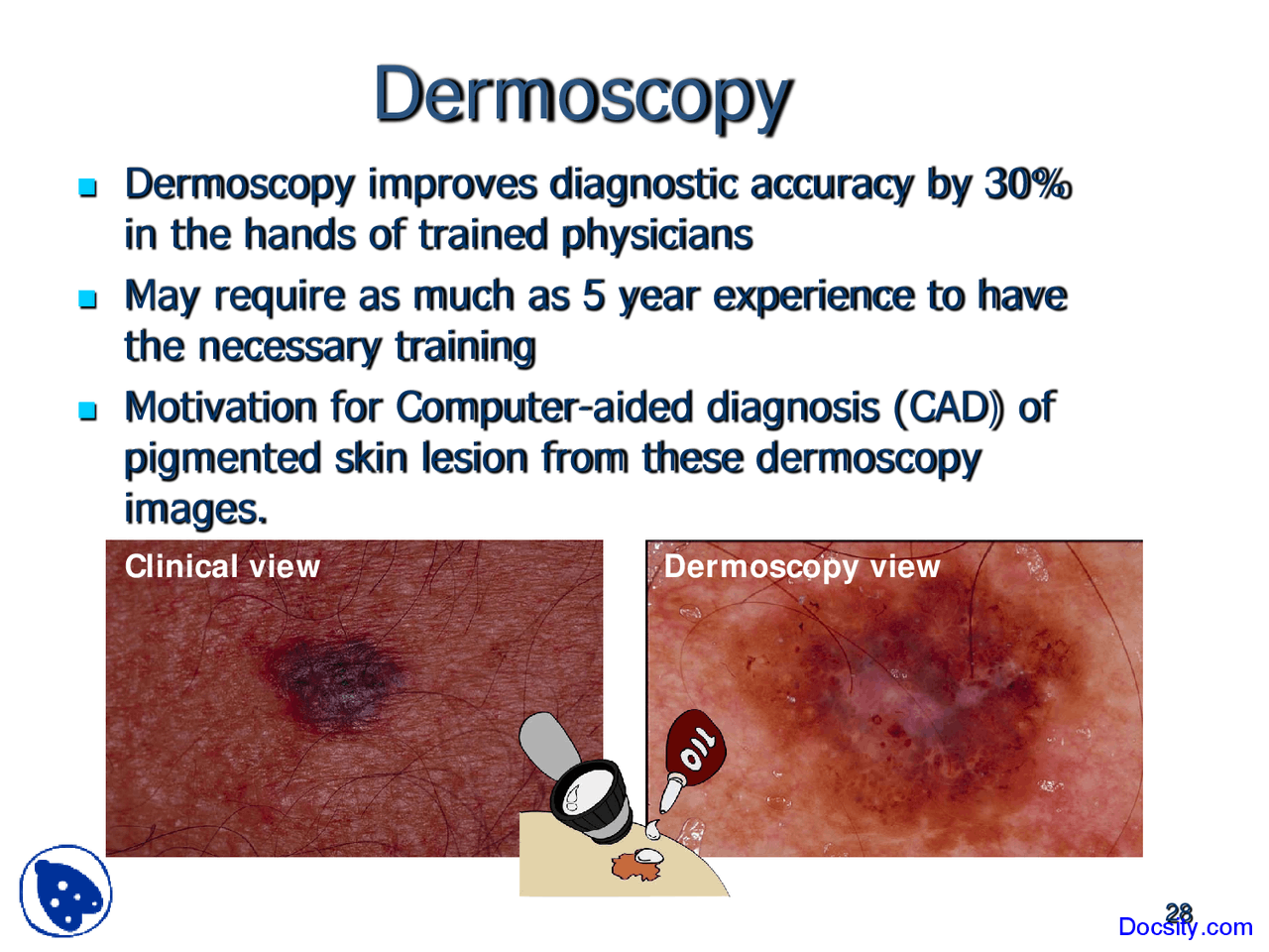 Dermoscopy Robot Vision And Preception Lecture Slides Docsity
