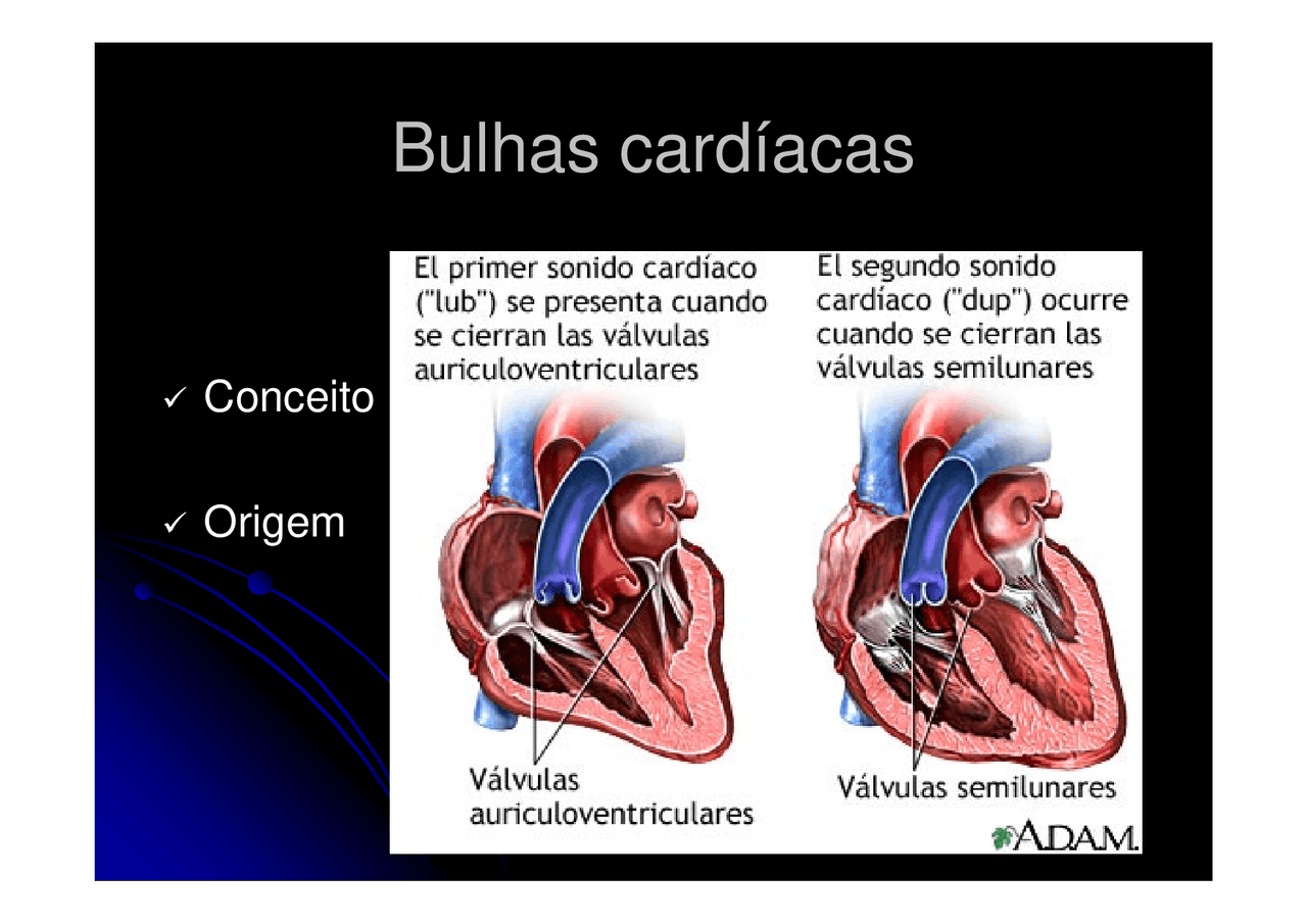 Bulhas Cardíacas e Eletrocardiografia - Apostilas - Fisioterapia Parte1 ...