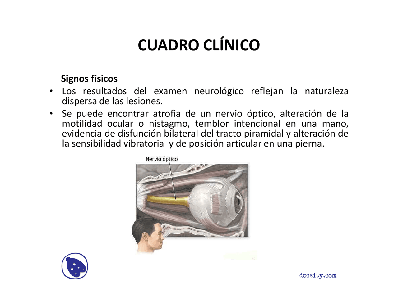 Esclerosis Múltiple Apuntes Neurología Parte2 Docsity