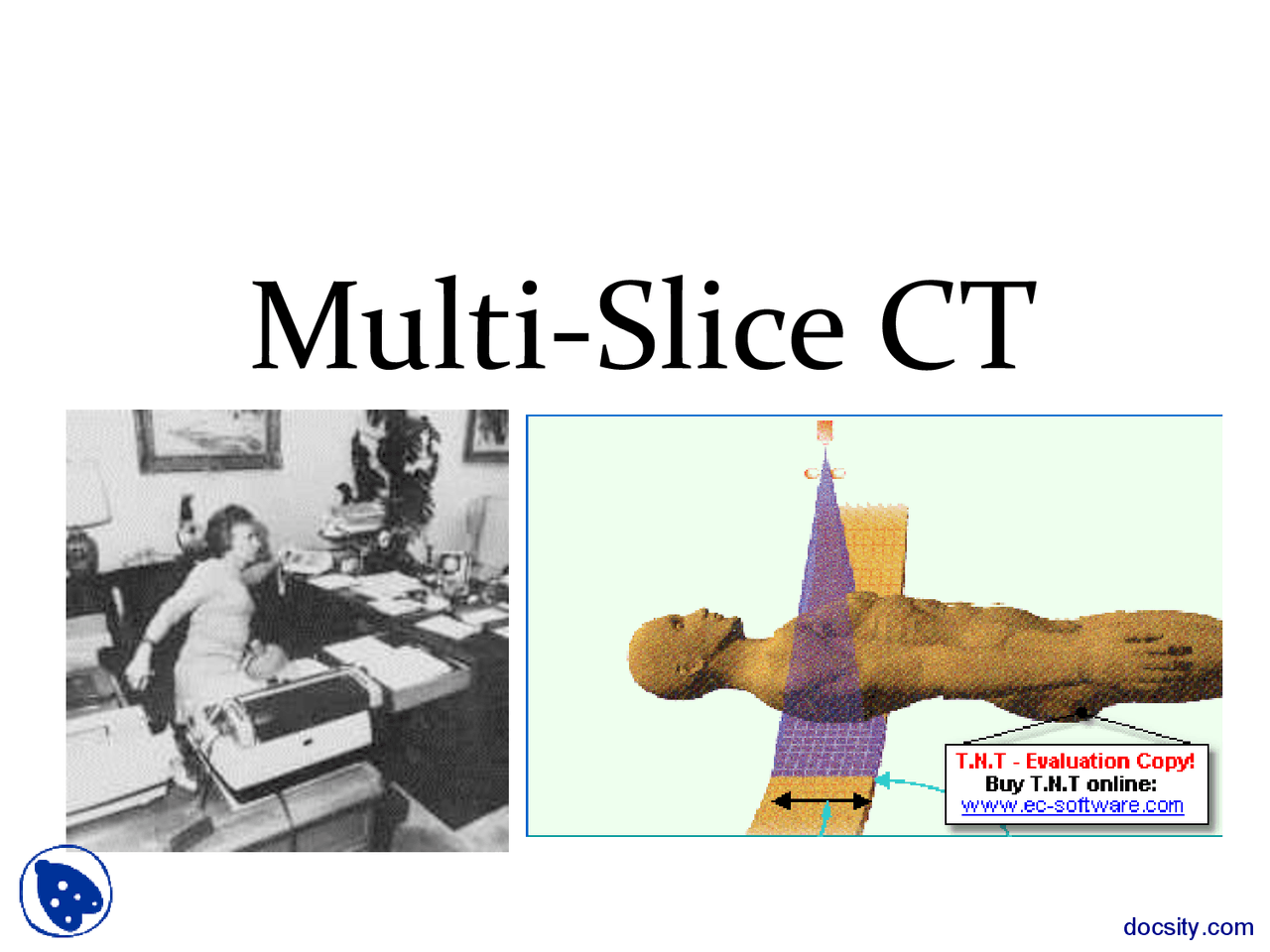 Multi Slice Ct Computed Tomography Lecture Slides Slides Computed