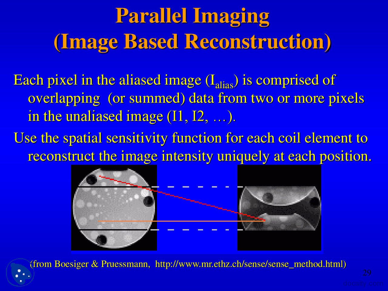 Multichannel Technology and Parallel Imaging3 - Magnetic Resonance ...