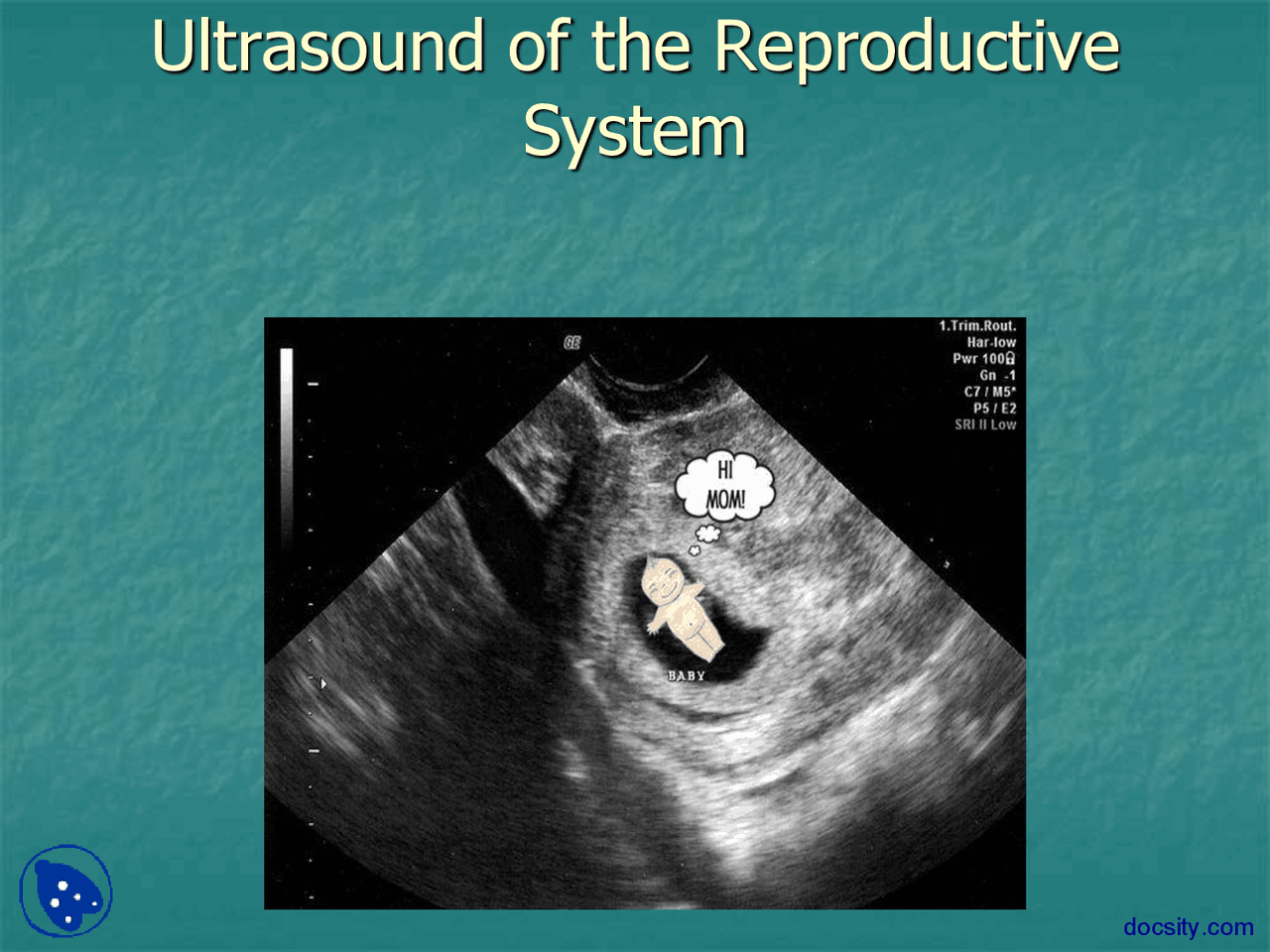 Ultrasound Of Reproductive System Radiology Lecture Slides Slides