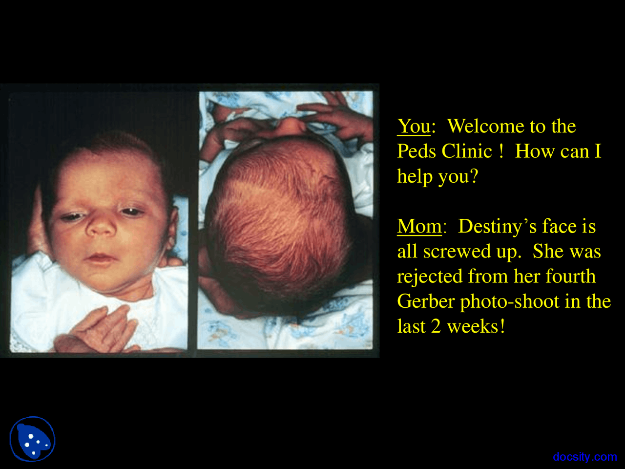 Craniosynostosis Pediatric Lecture Slides Docsity
