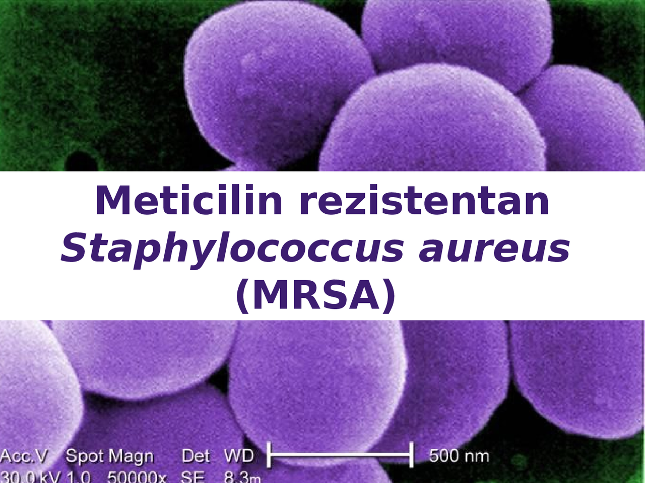 Meticilin rezistentan Staphylococcus aureus (MRSA) | Vežbe' predlog Mikrobiologija - Docsity