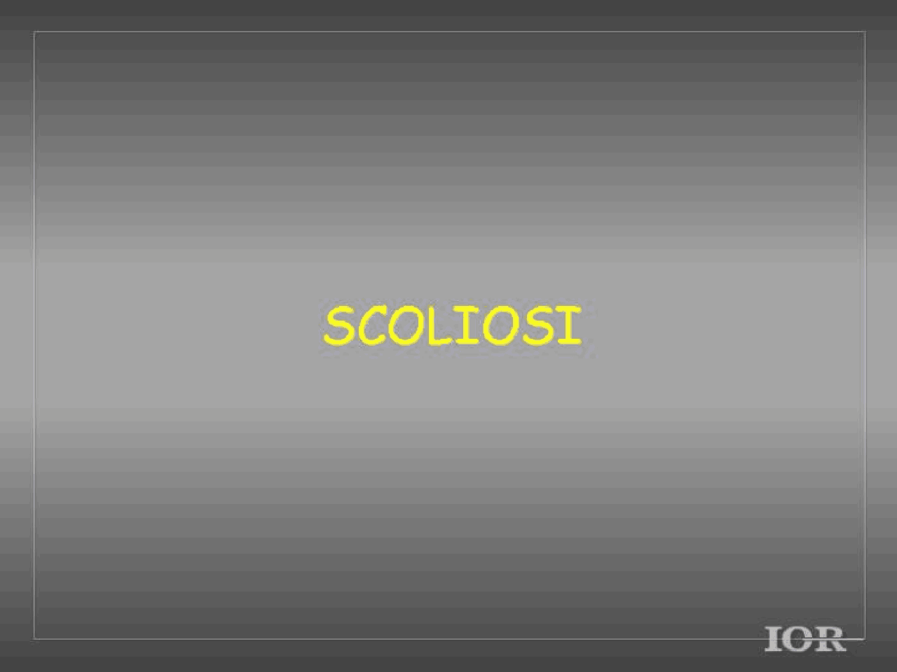 Scoliosi Docsity