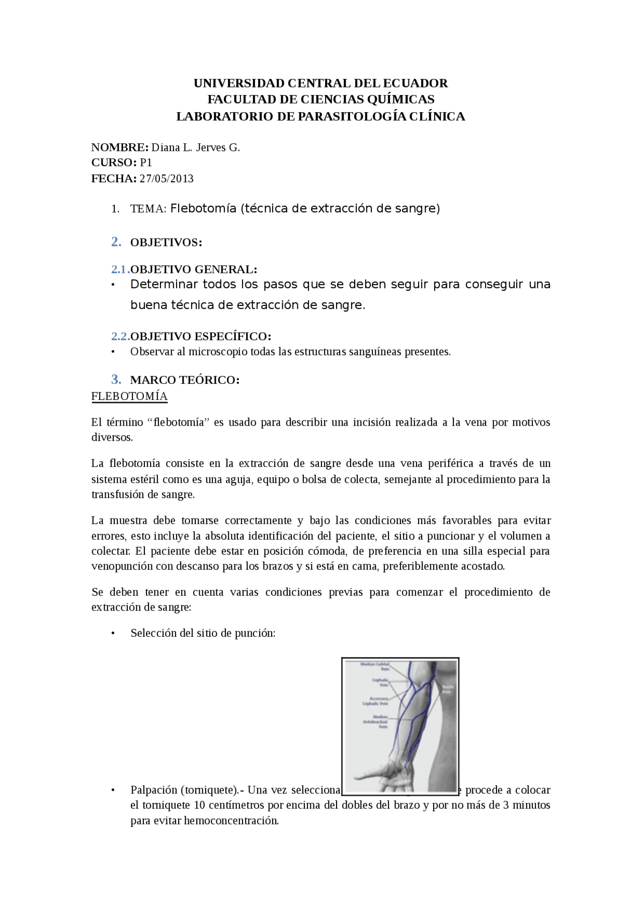 Flebotomía Docsity
