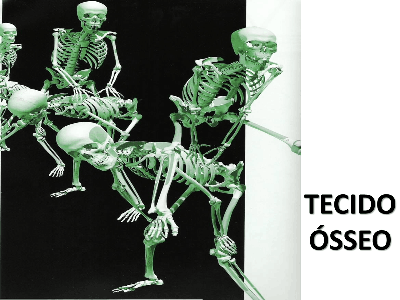 Aula 08 Histologia Humana Tecido Ósseo Docsity
