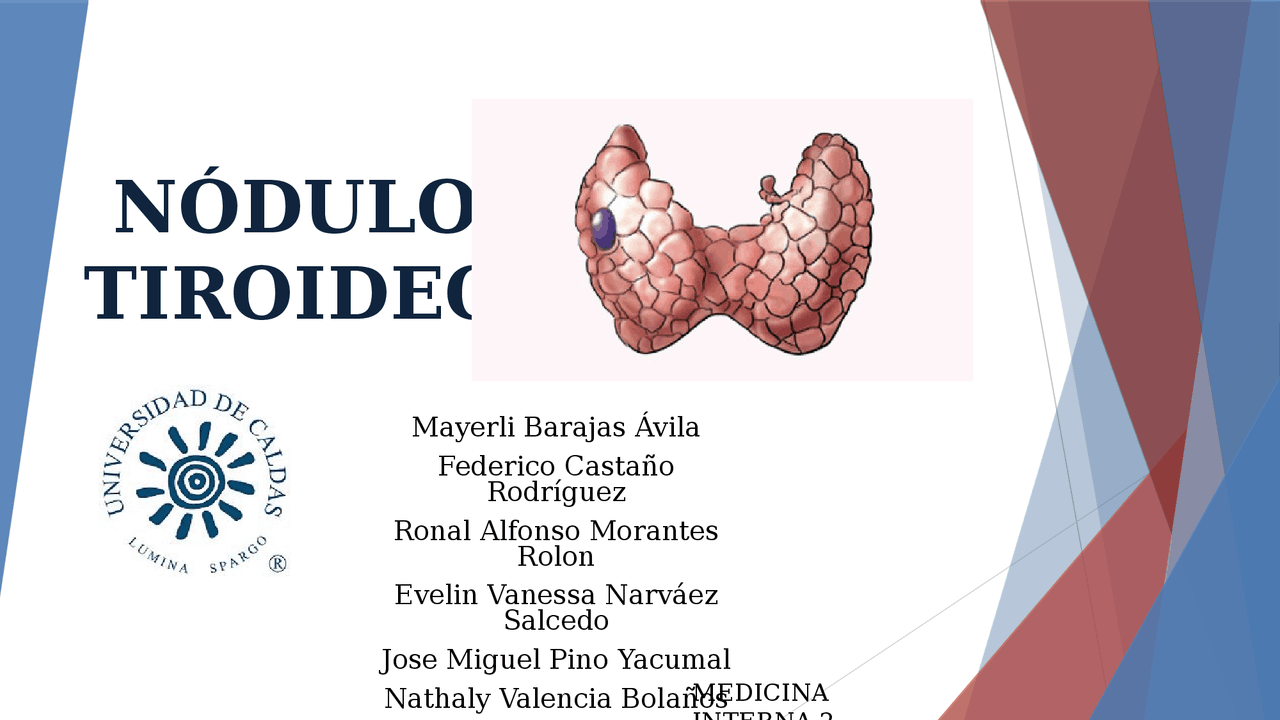 Presentación de nódulo tiroideo | Diapositivas de Medicina | Docsity
