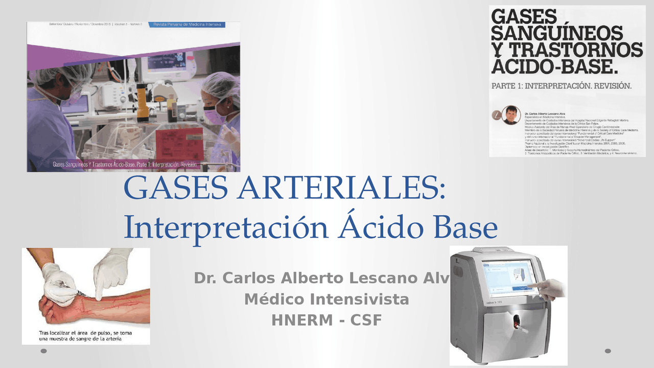 Como entender uma AGA - Docsity