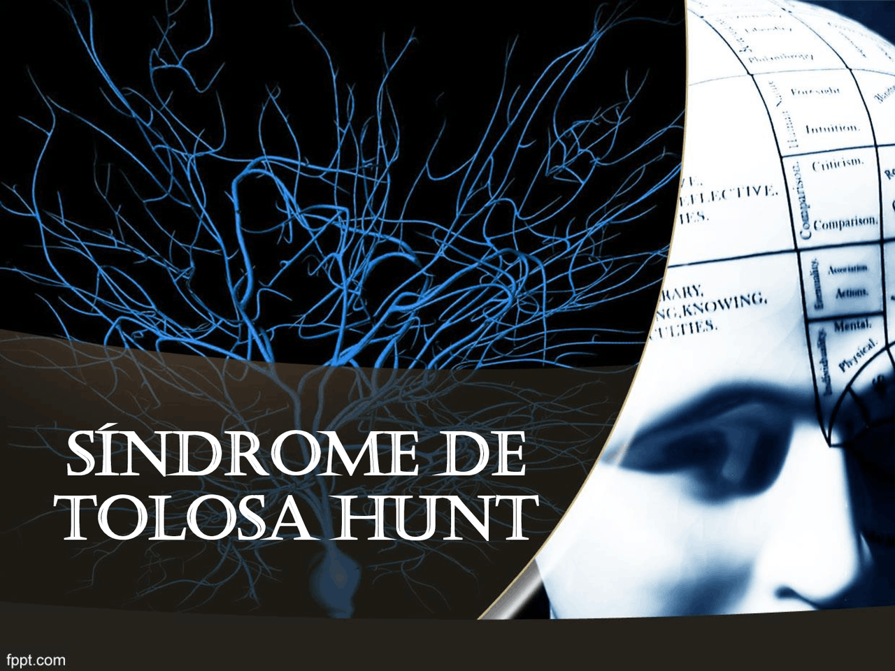 Síndrome de Tolosa Hunt - Docsity