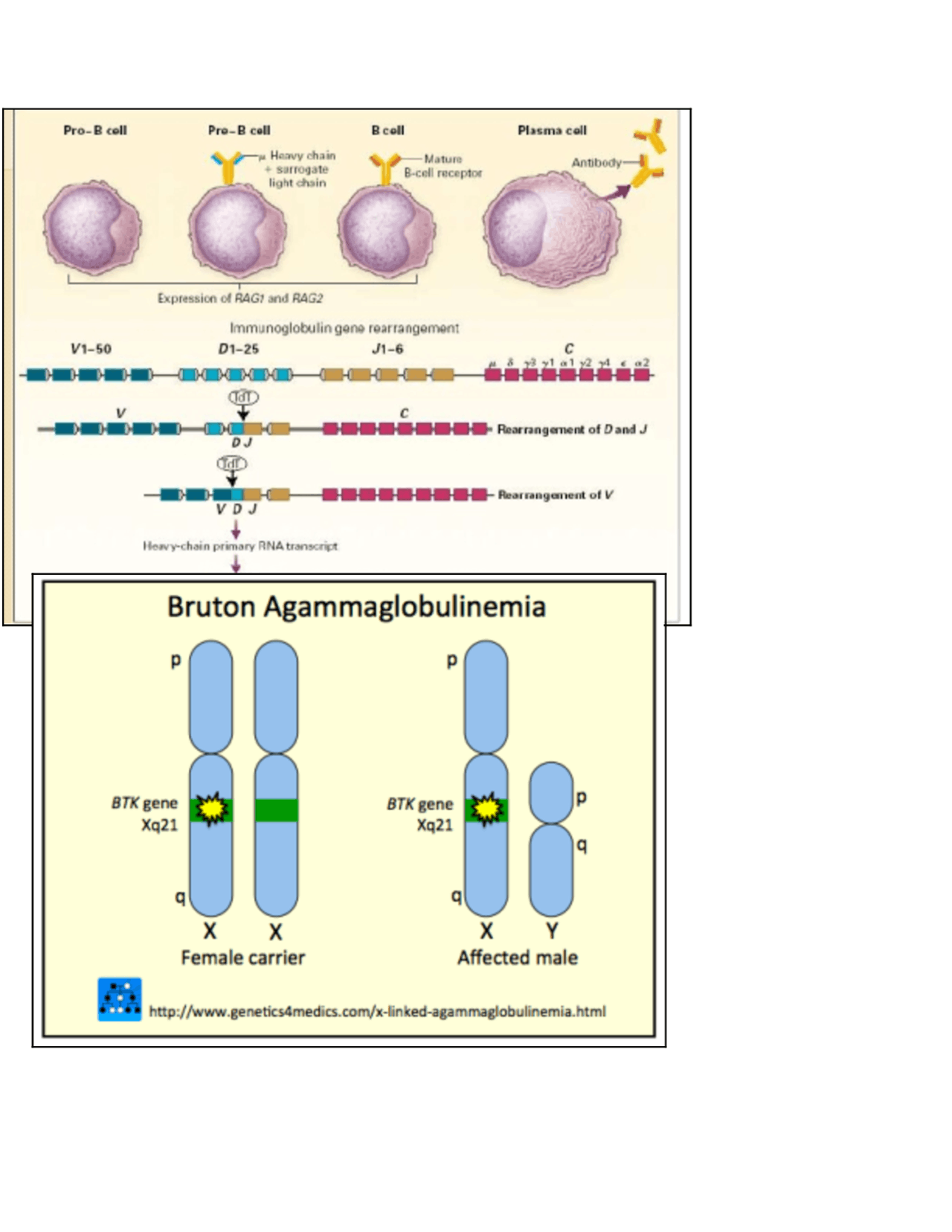 agammaglobulinemia-descripci-n-docsity